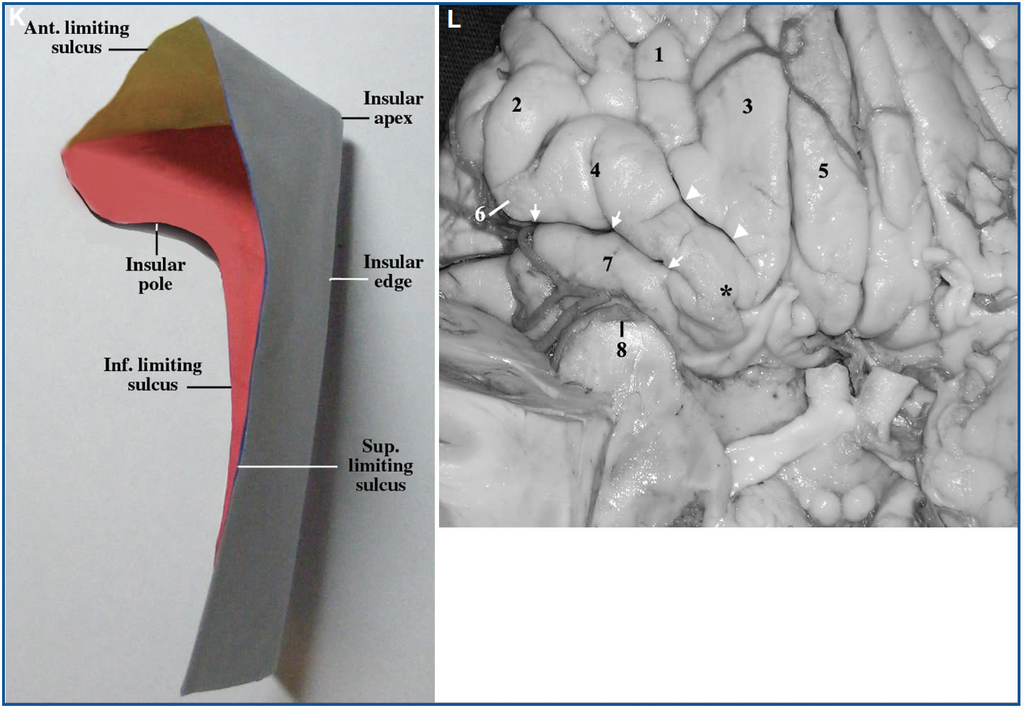 The Insular Region | Neuroanatomy | The Neurosurgical Atlas