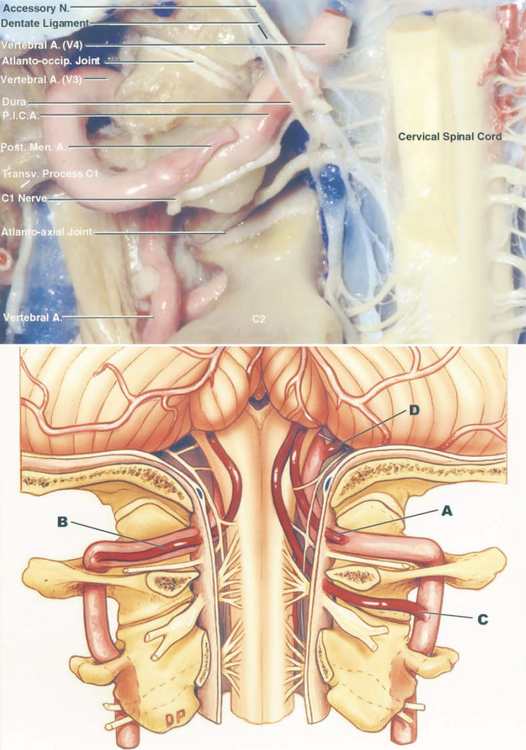 The Brainstem and Intradural Segment of the VA and PICA | Neuroanatomy ...