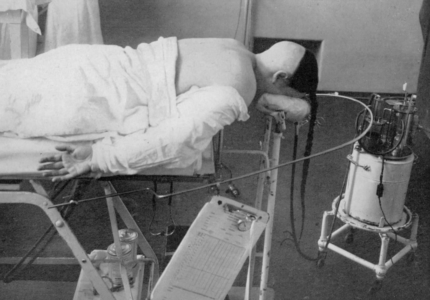 Skull Clamp Placement | Cohen Collection | Volumes | The Neurosurgical ...