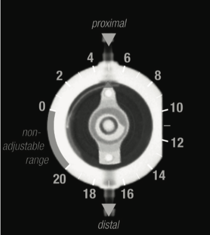 Ventricular Shunt Reference | Cohen Collection | Volumes | The ...