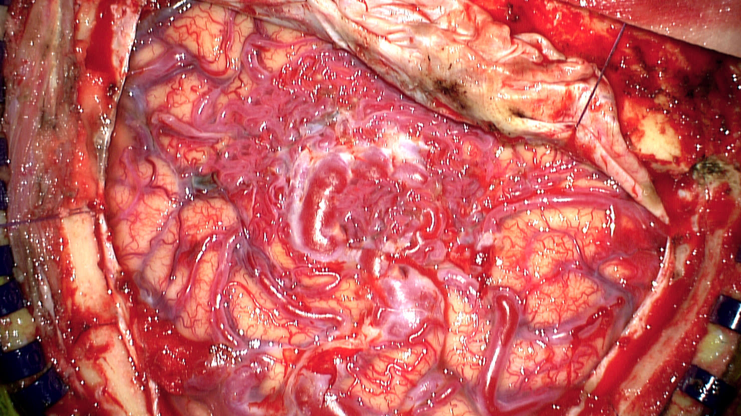 General Principles of AVM Management | Cohen Collection | Volumes | The ...