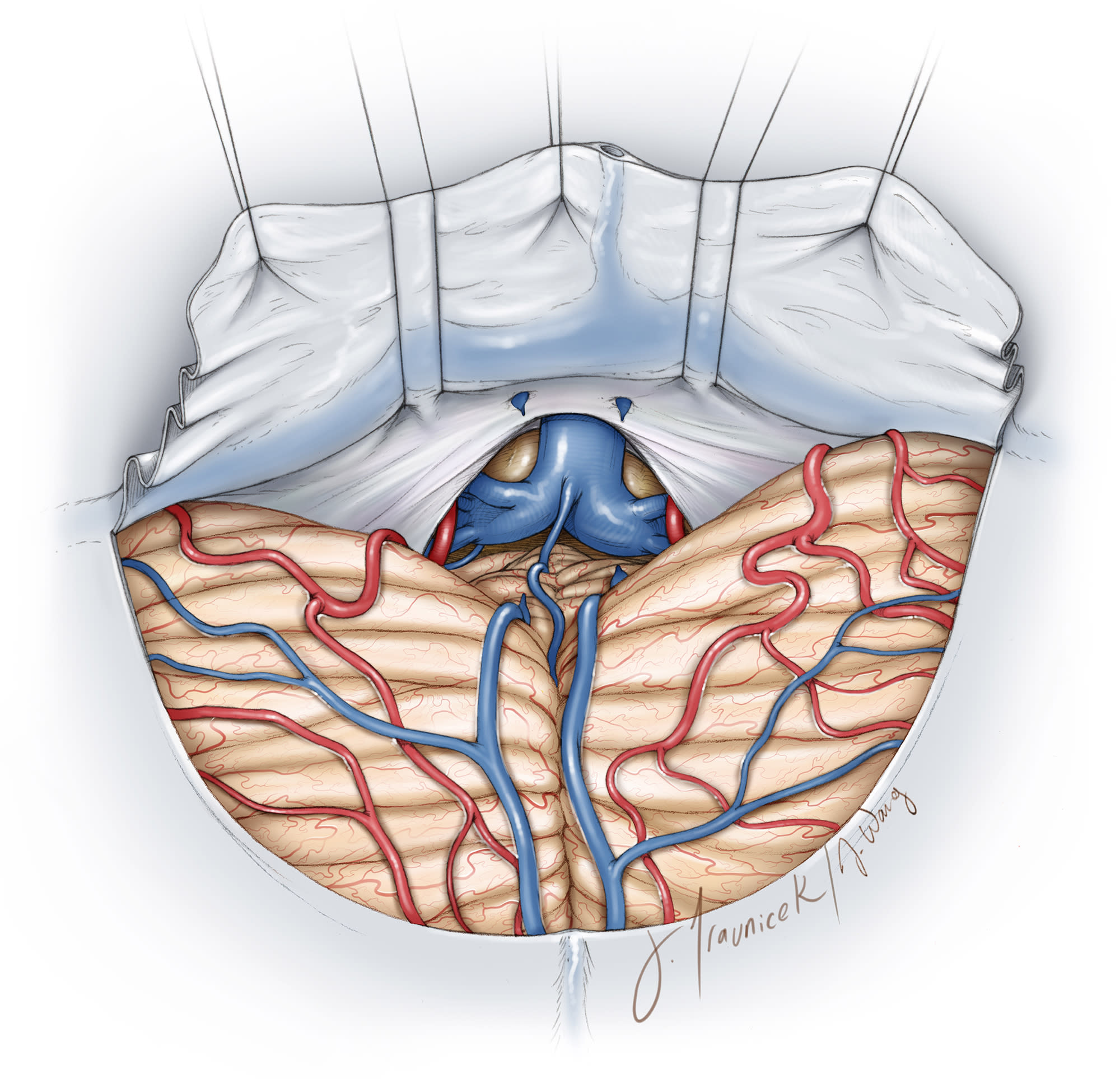 Selection of Operative Corridor | Cohen Collection | Volumes | The ...