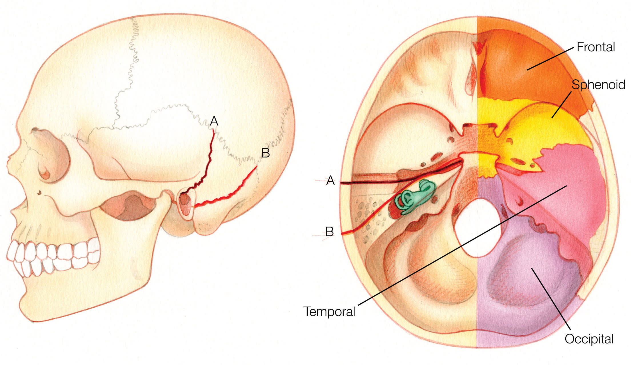 Base Of The Skull Fracture