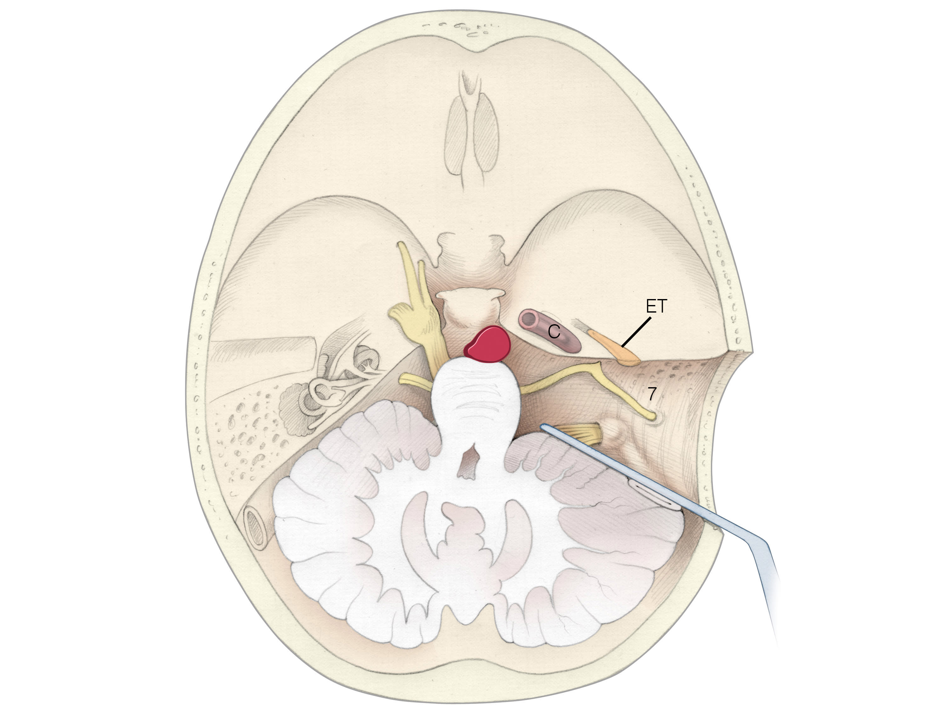 Vascular Considerations | Jackler Collection | Volumes | The ...