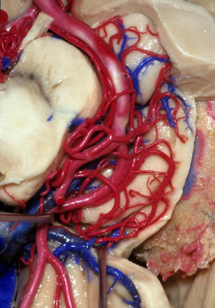 Crural and Ambient Cisterns | Neuroanatomy | The Neurosurgical Atlas