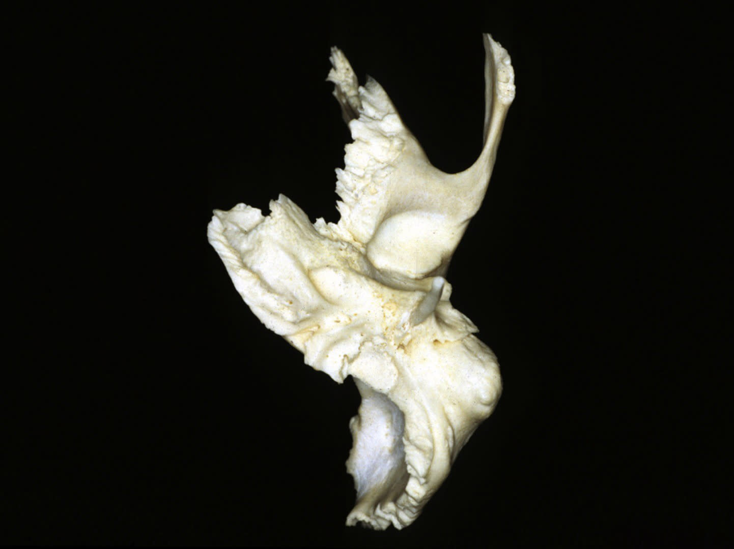 Inferior View of Left Temporal Bone | Neuroanatomy | The Neurosurgical ...