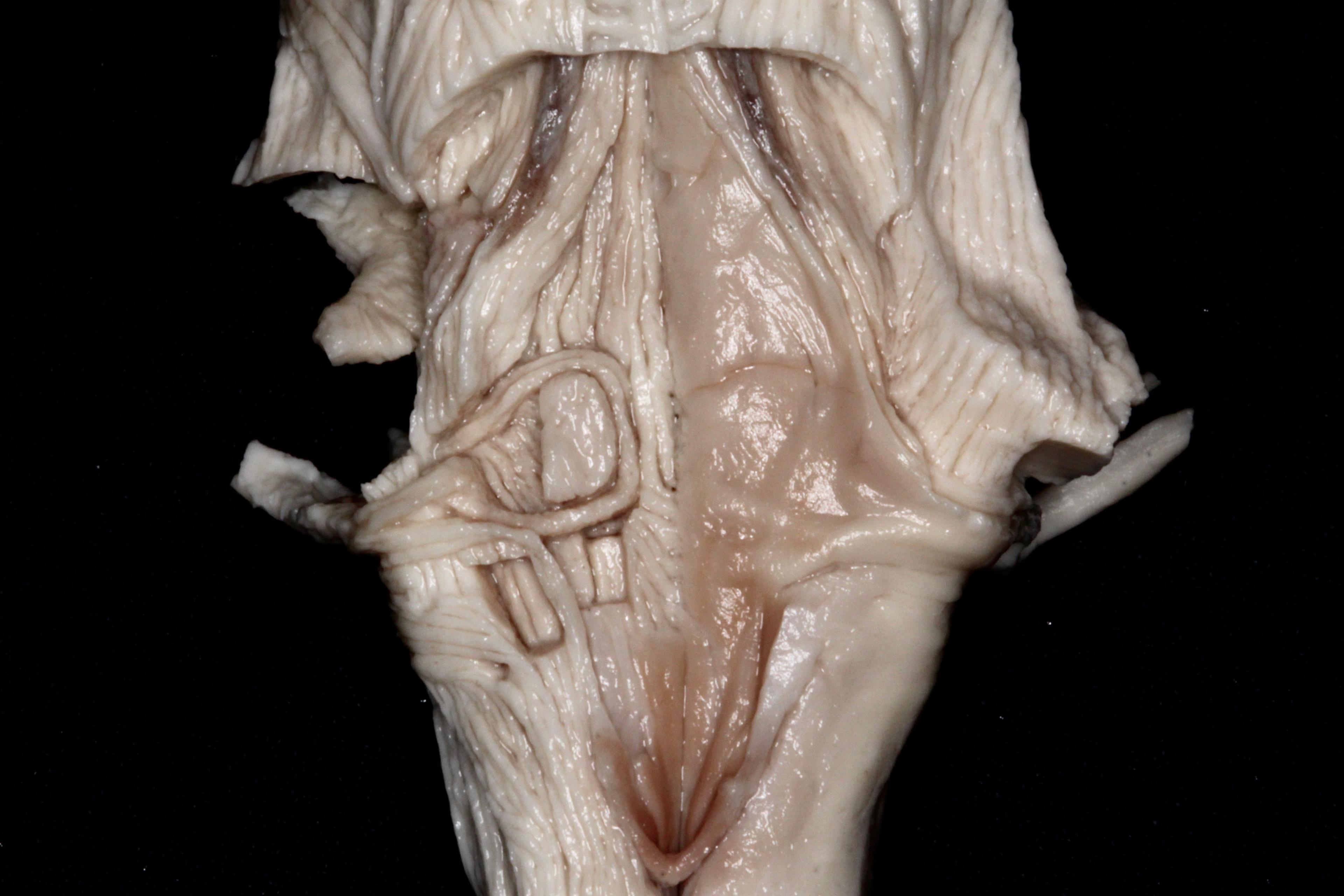 Posterior View of Dissected Brainstem and Fourth Ventricle ...