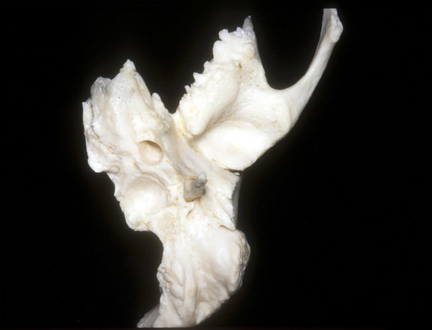 Inferior View of Left Temporal Bone | Neuroanatomy | The Neurosurgical ...