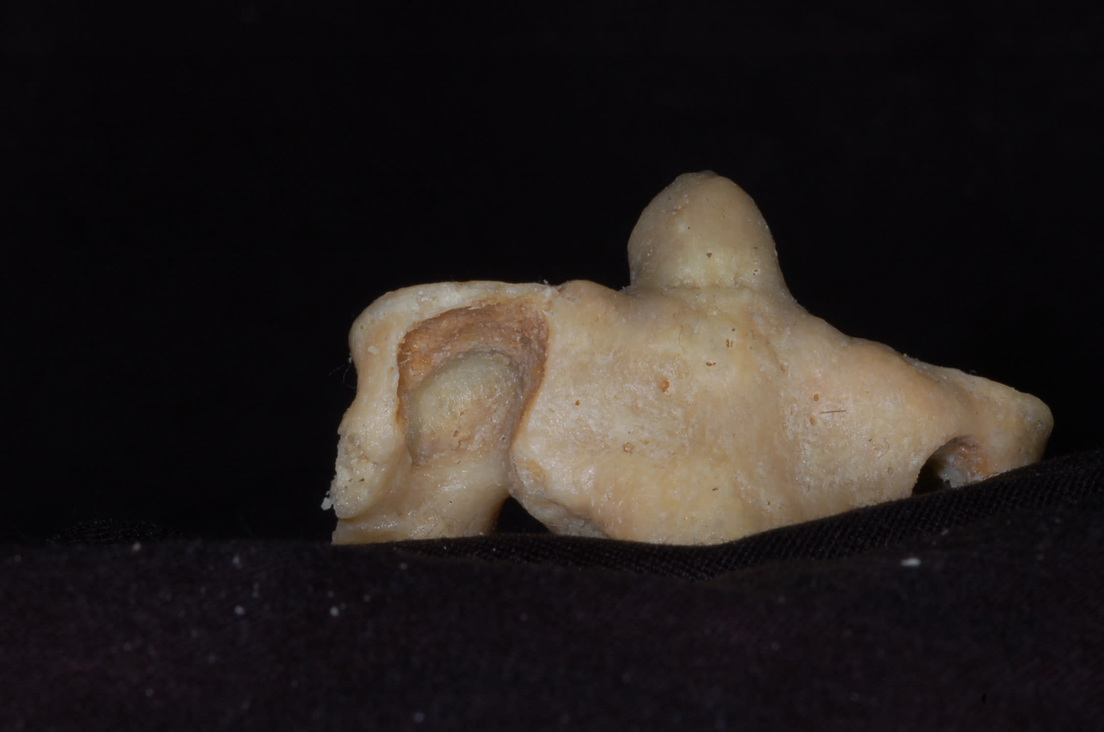 Anterior Oblique View of Axis Vertebra | Neuroanatomy | The ...