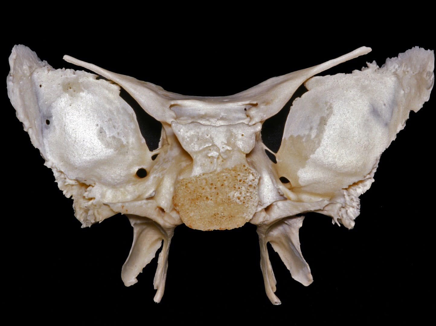 Posterior View of the Sphenoid Bone | Neuroanatomy | The Neurosurgical ...