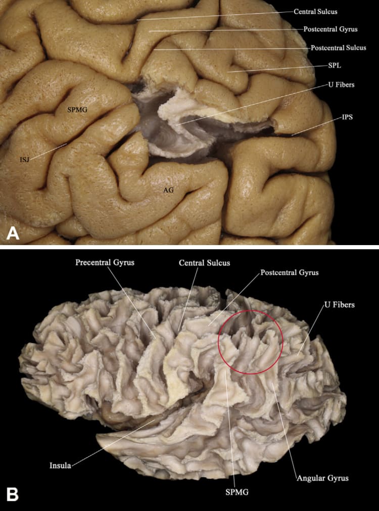 Lateral View of the Brain Centered at the Level of the Intraparietal ...