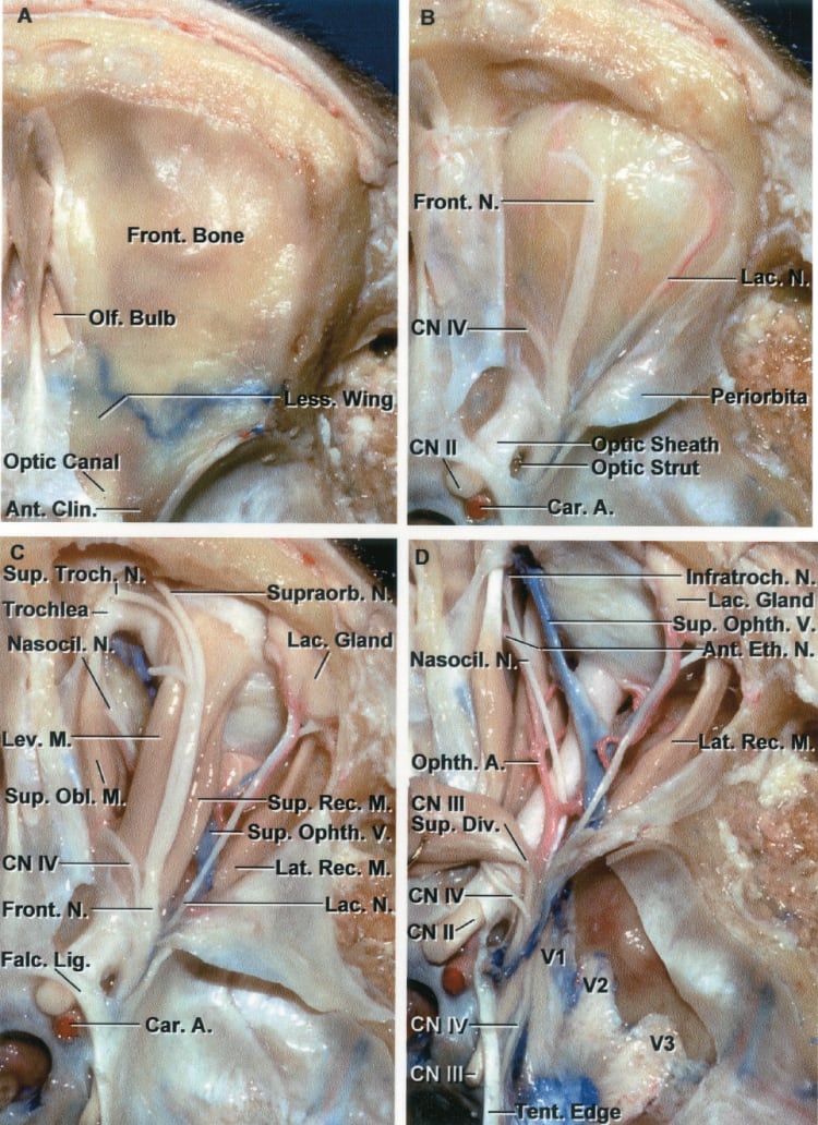 Far-Lateral and Transcondylar Approach | Neuroanatomy | The ...