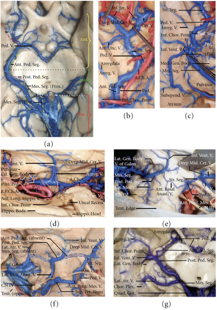 The Basal Vein and Its Tributaries | Neuroanatomy | The Neurosurgical Atlas