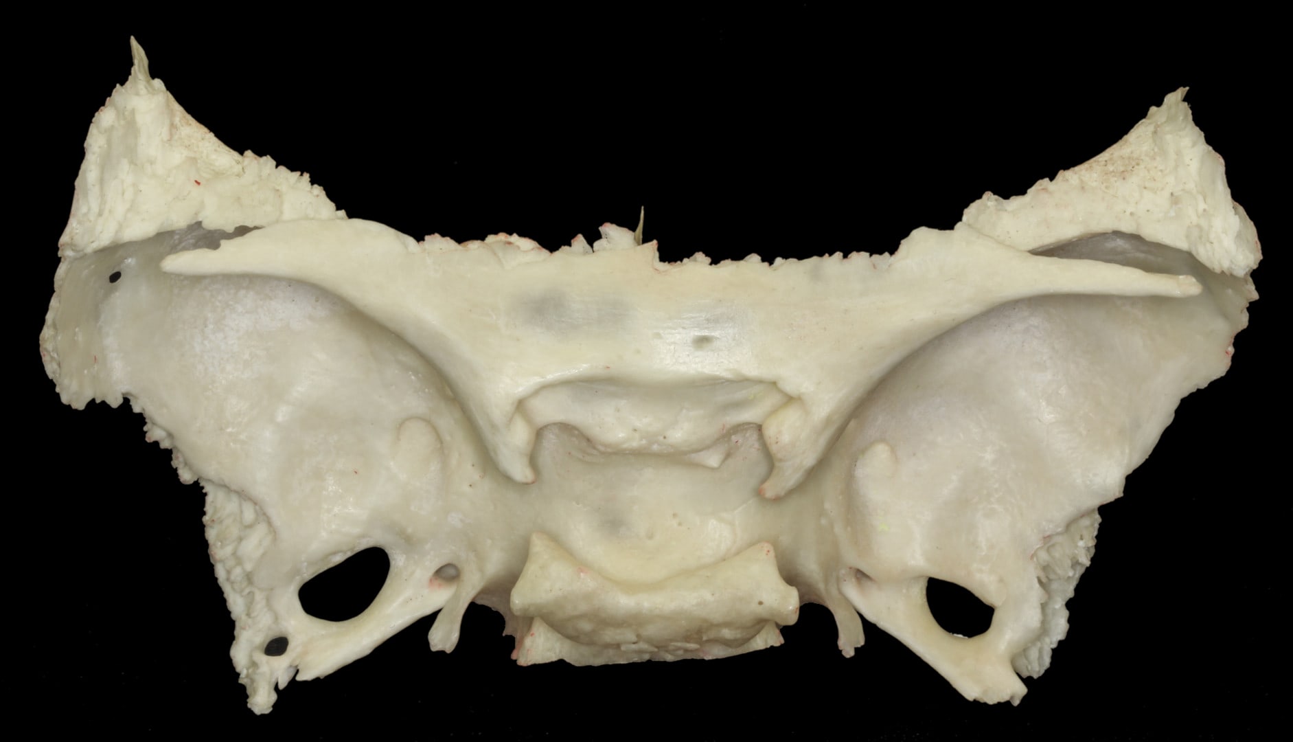 Sphenoid Bone Superior View
