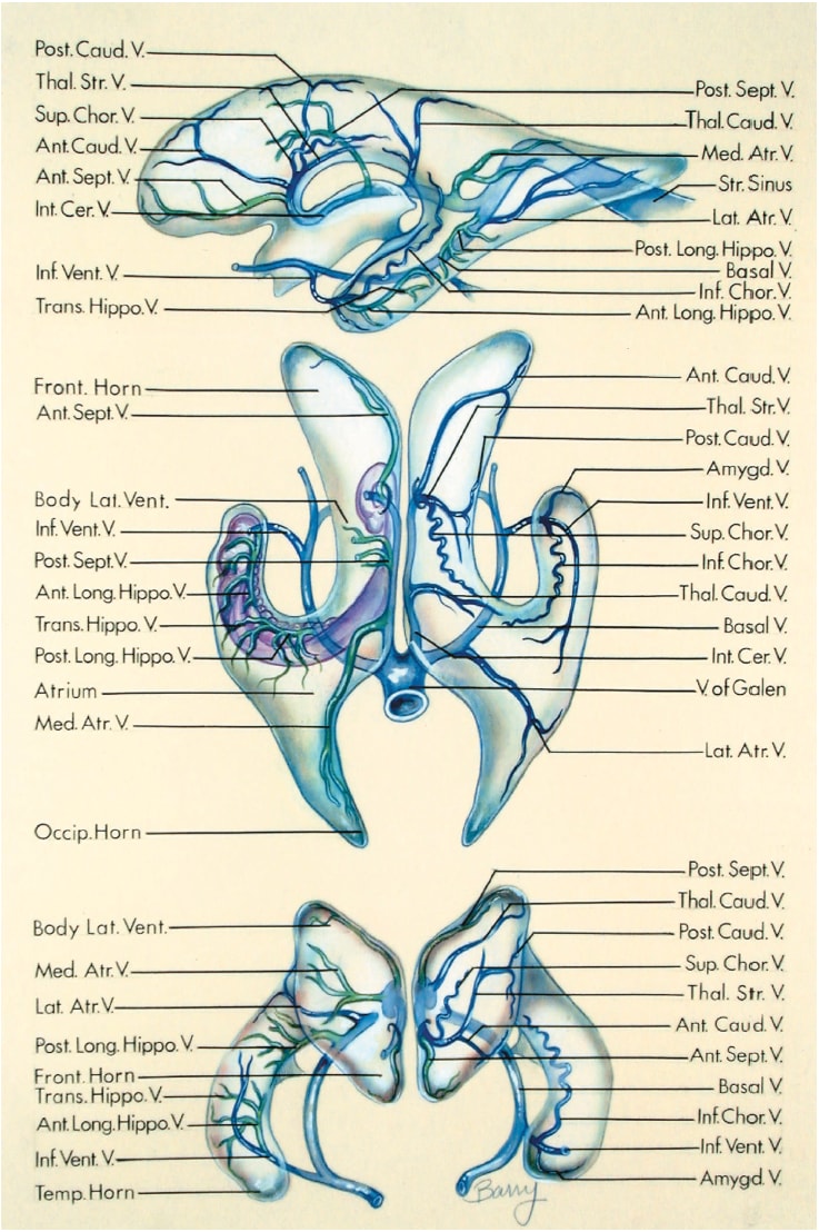 Lateral Ventricle Model Dr. Benaduce: Ventricles Of The Brain