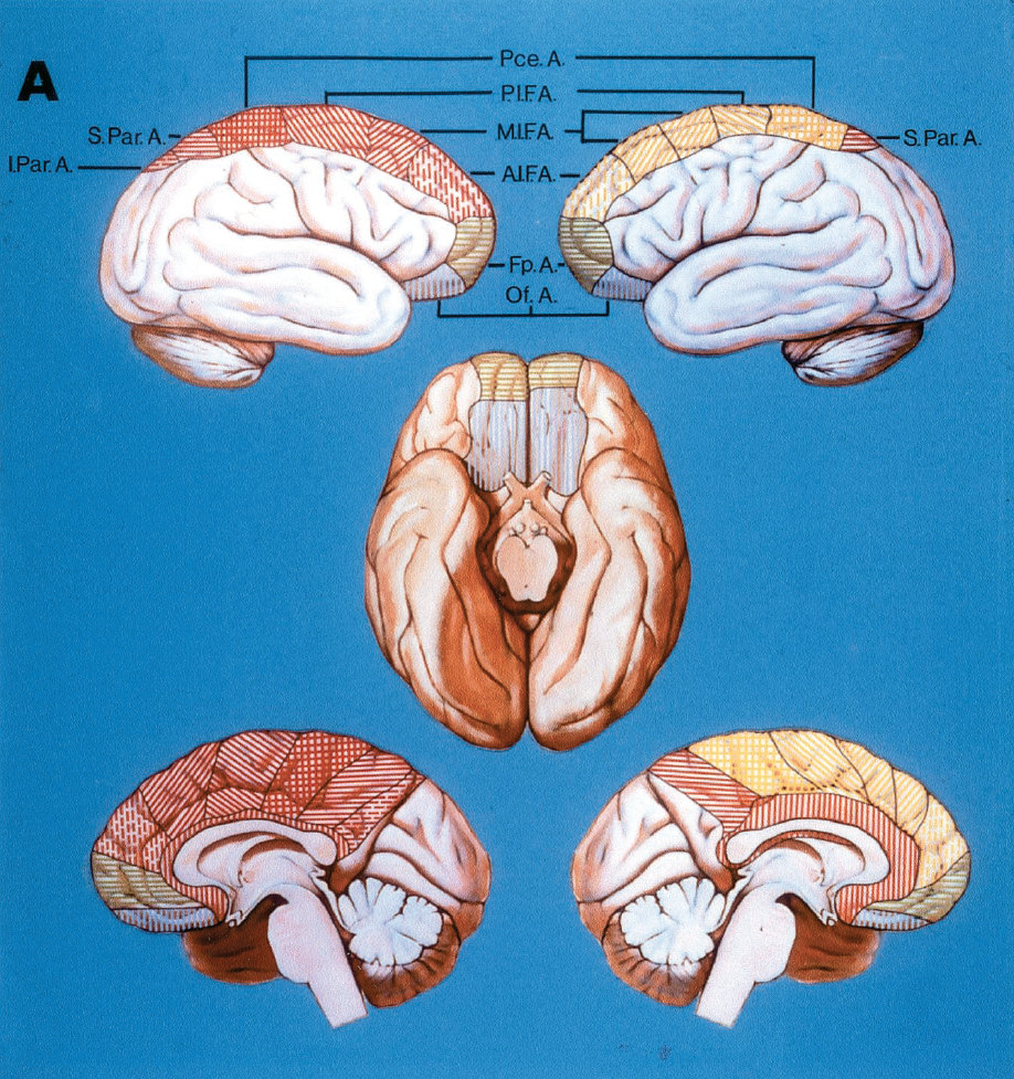 Anterior Cerebral Artery Anatomy Anterior Cerebral Artery | Radiology