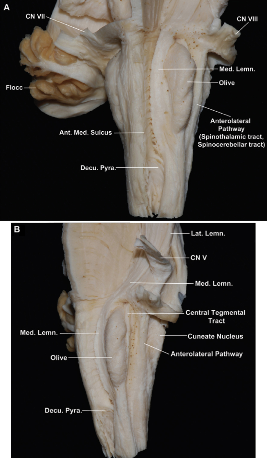 Real Medulla Oblongata Medulla Oblongata | Description, Anatomy,