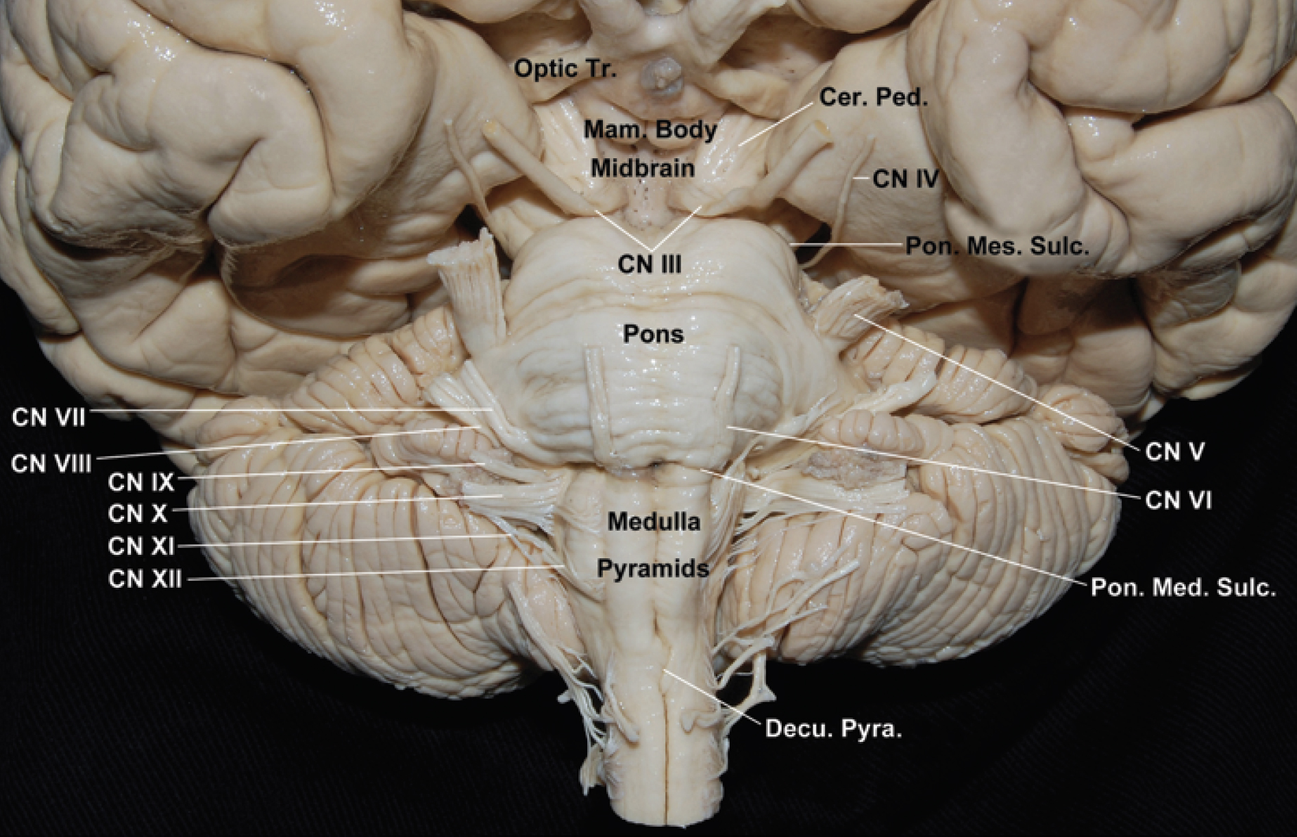 Brainstem Anatomy Child's Brain Anatomy By Neuroscience Experts