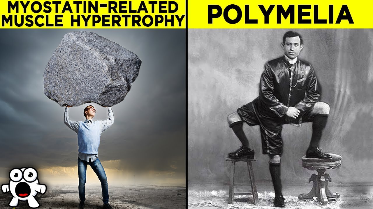 Rare Diseases That Give People Superhero-Like Abilities | Be Amazed