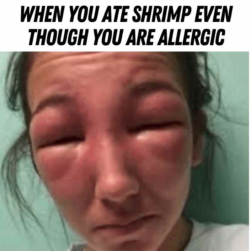 Shrimp Allergy Memes Food Allergy GIFs | Tenor