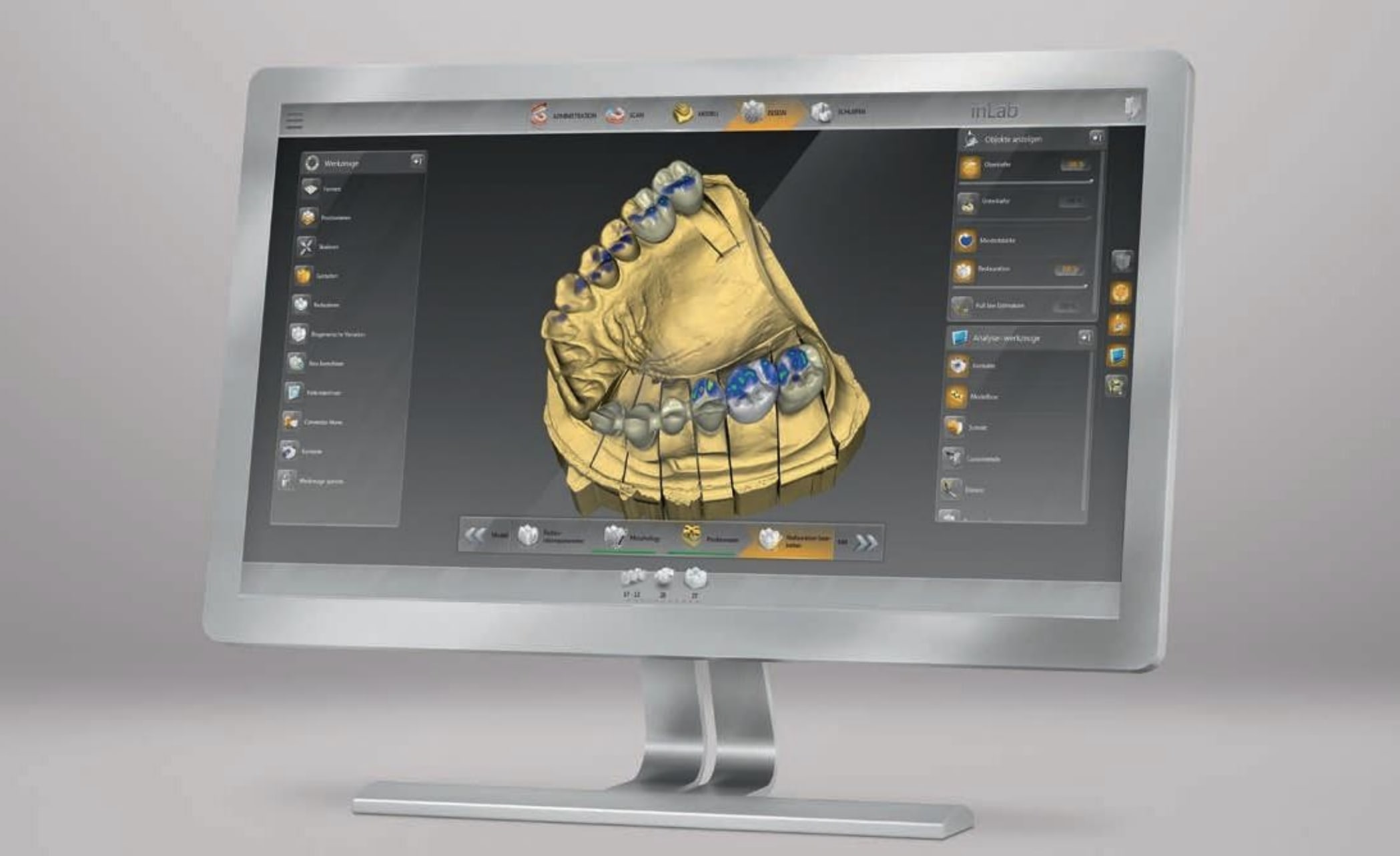 InLab Design Jacobsen Dental