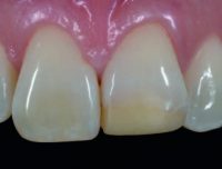 “Style Italiano” Jacobsen Dental