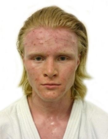 Markus EDLUND / IJF.org