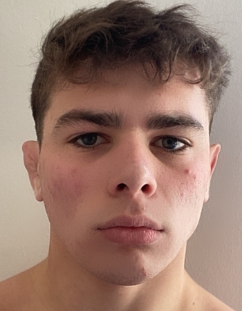 Alberto MAGNANO / IJF.org