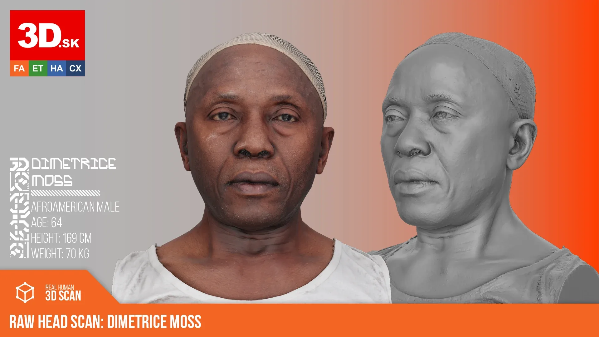 Raw Head Scan | 3D Model Dimetrice - FlippedNormals