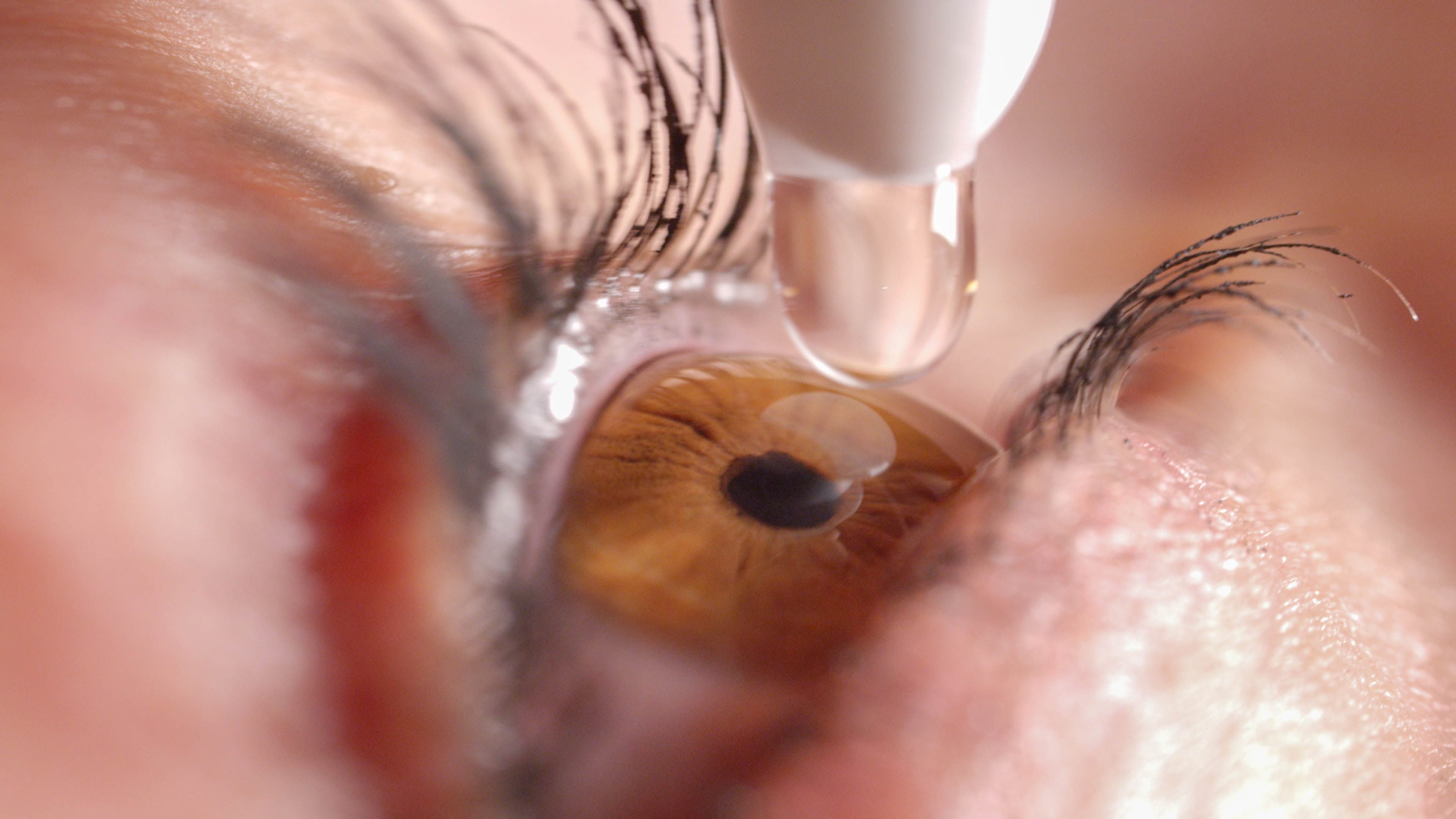 iView Therapeutics |Becoming a Leader in Ophthalmic Therapeutics|