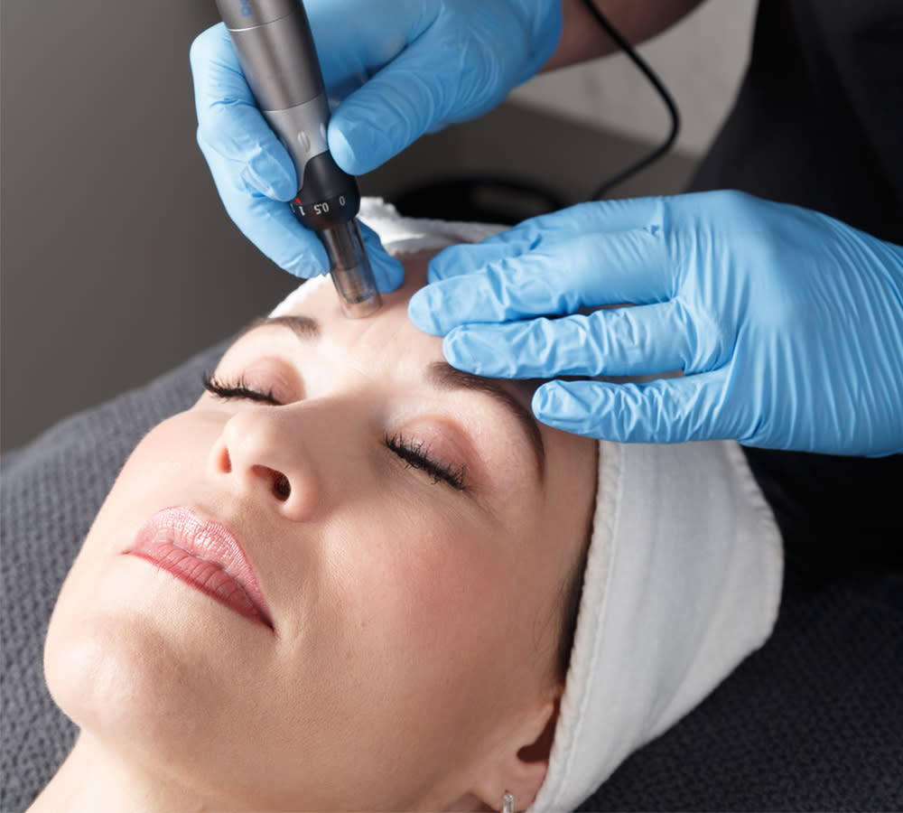 Acne Eden Medispa Award Winning Aesthetic Clinic George