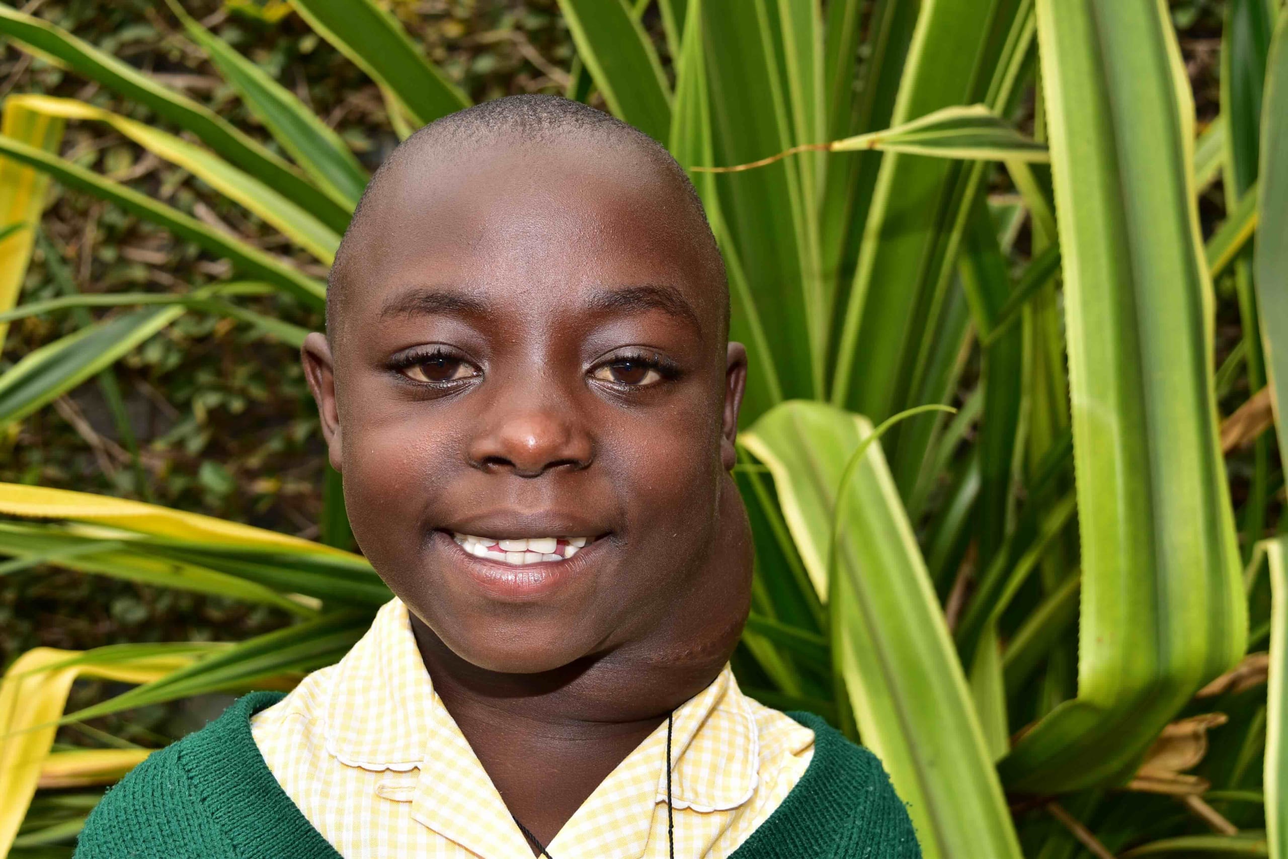 Nuestros pacientes - Humanity Direct