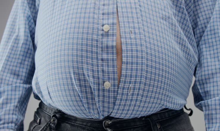 10 Cara Mengatasi Obesitas Optimal untuk Meningkatkan Kesehatan