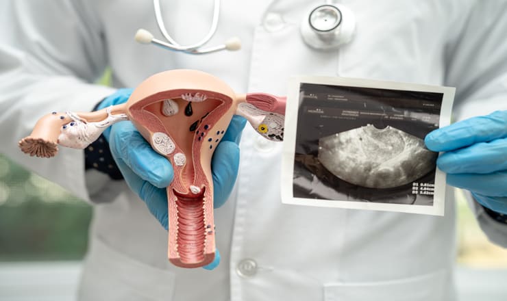 Cyst Disease: Causes, Symptoms, and Treatments