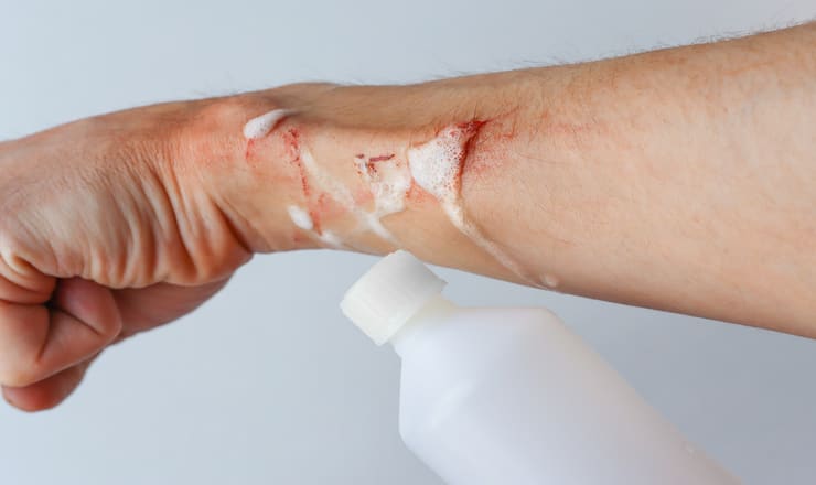 Recommended Wound Healing Medicines: 16 Options at Your Local Pharmacy