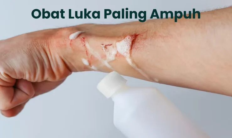 16 Obat Luka Ampuh yang Dapat Ditemukan di Apotek untuk Menyembuhkan Cepat