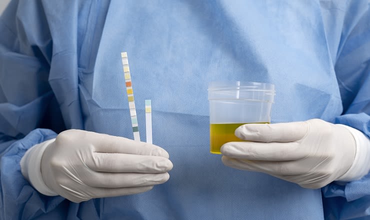 Fungsi dan Manfaat Tes Urine: Prosedur, Jenis, dan Harga Lengkap di Prodia
