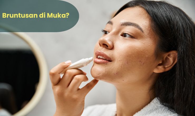 8 Cara Menghilangkan Bruntusan di Wajah dengan Cepat dan Tepat