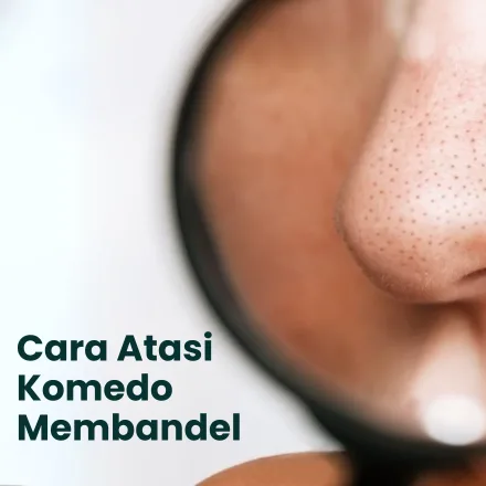 7 Cara Menghilangkan Komedo Secara Alami