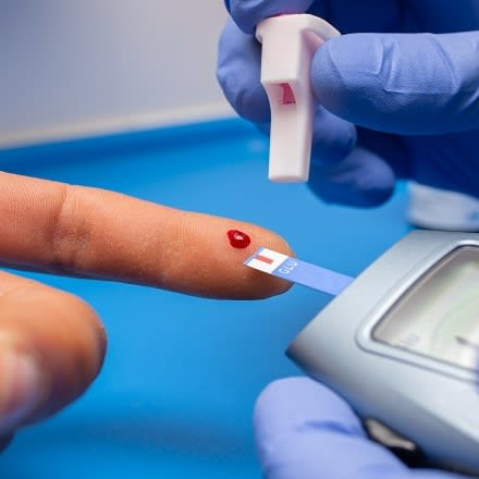 Learn About the Many Types of Glucose Test