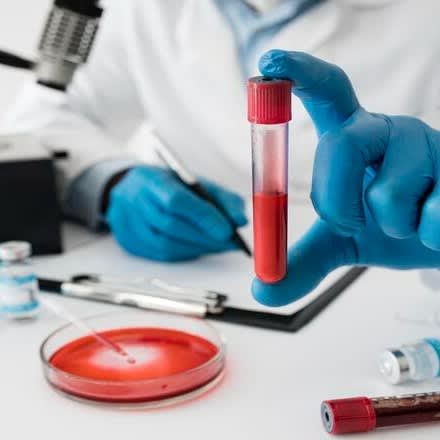 Cek Hemoglobin: Fungsi, Prosedur, dan Biaya Pemeriksaan