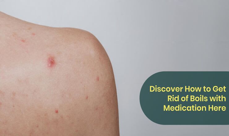 Effective Boil Treatment: Tablets, Ointment, and Powder