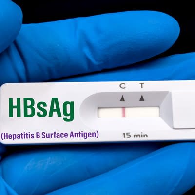 Procedure for Hepatitis B Testing: Types of Tests, Prices, and Results