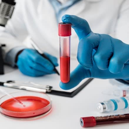 Guide to Blood Tests for Typhoid Fever: Types, Names, and Interpretations