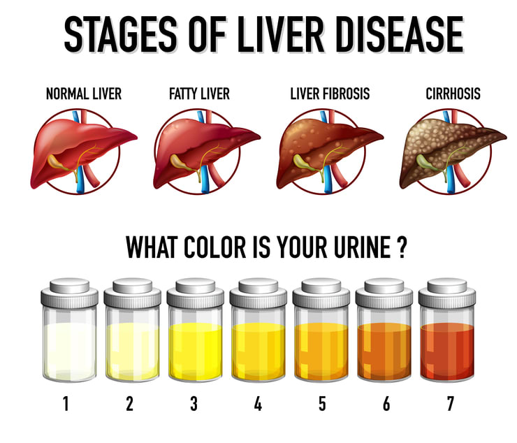 Understanding Liver Function Tests Types Symptoms And Panels