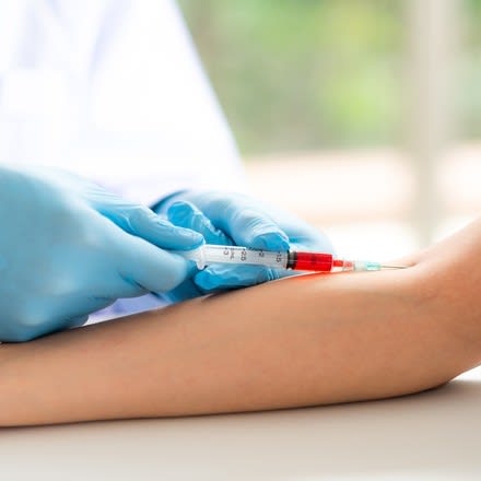Understanding HbA1c Test: Procedure, Interpretation, and Significance