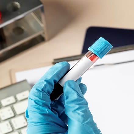 Normal Uric Acid Levels in Males and Females