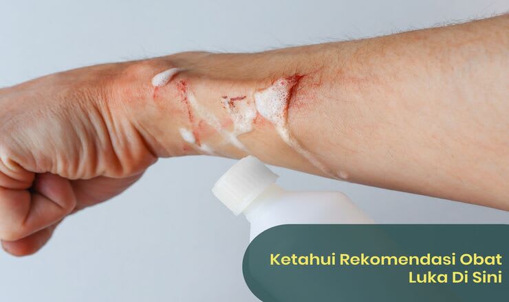 16 Obat Luka Ampuh yang Dapat Ditemukan di Apotek untuk Menyembuhkan Cepat