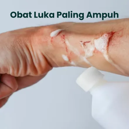 16 Obat Luka Ampuh yang Dapat Ditemukan di Apotek untuk Menyembuhkan Cepat