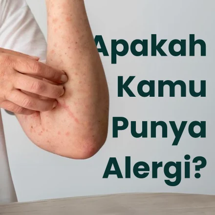Tes Alergi Prodia 2025: Biaya, Prosedur, dan Waktu Tes